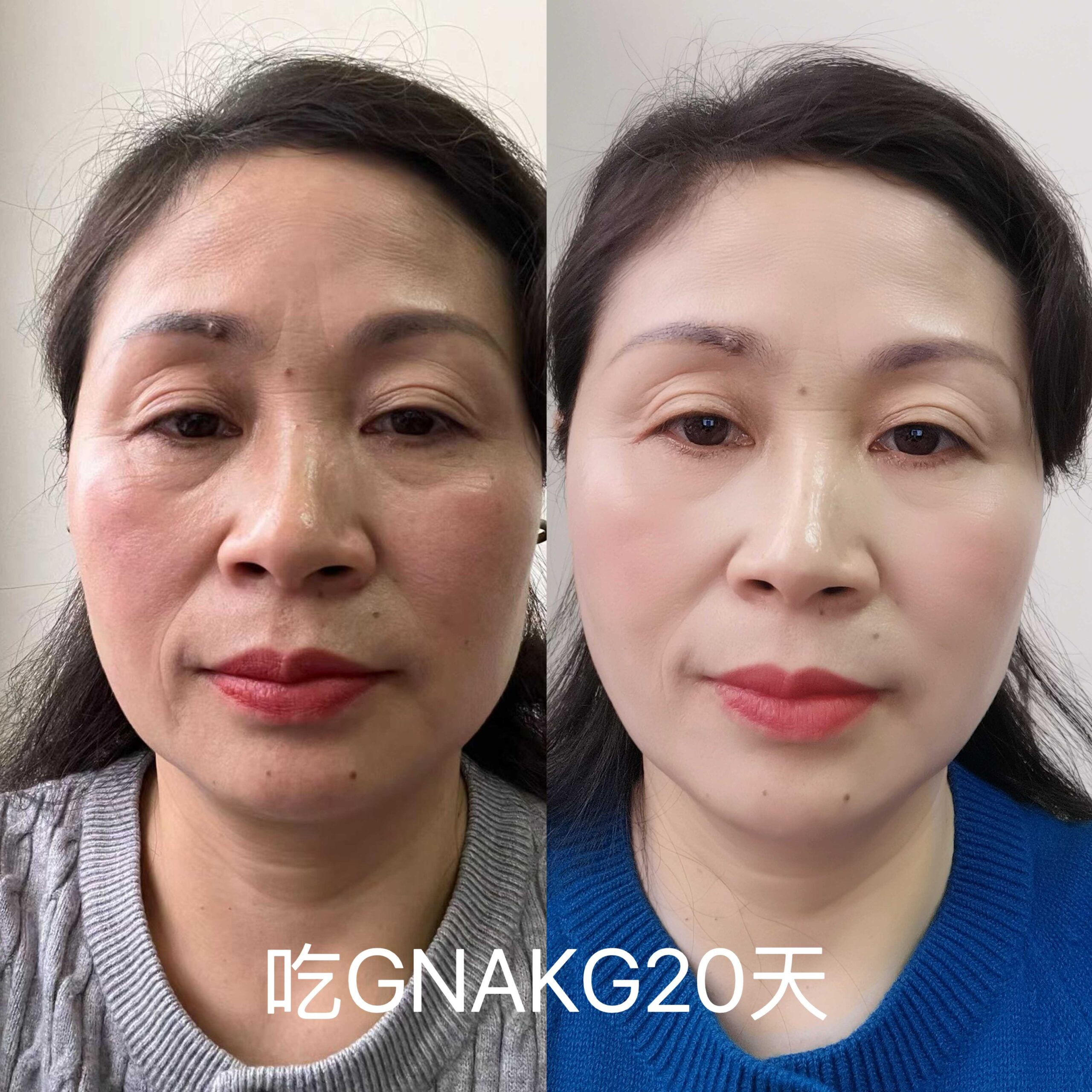 GNAKG产品使用案例 – HiGo GnAKG