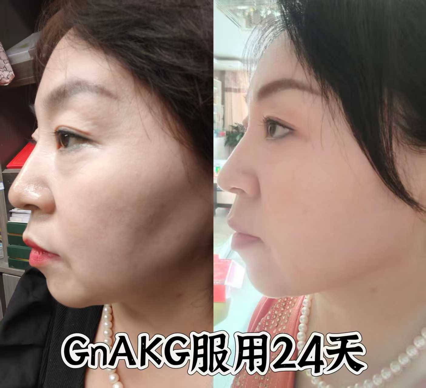 GNAKG产品使用案例 - HiGo GnAKG