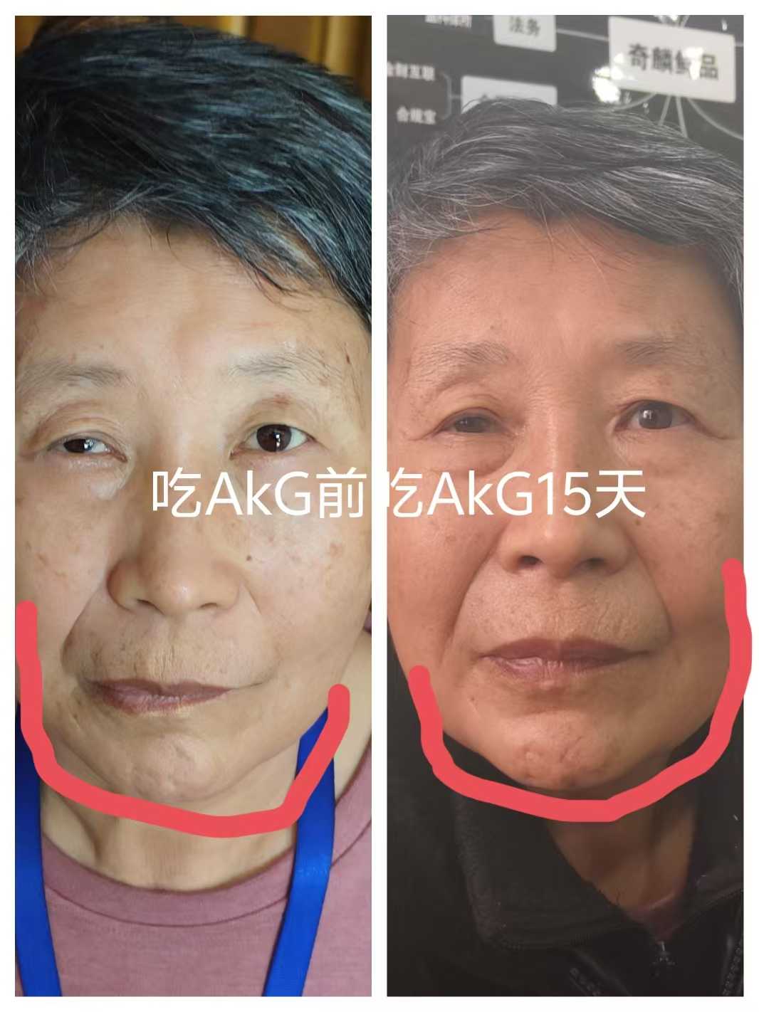 GNAKG产品使用案例 - HiGo GnAKG
