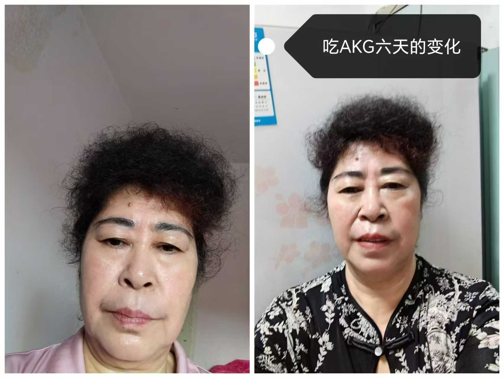 GNAKG产品使用案例 - HiGo GnAKG